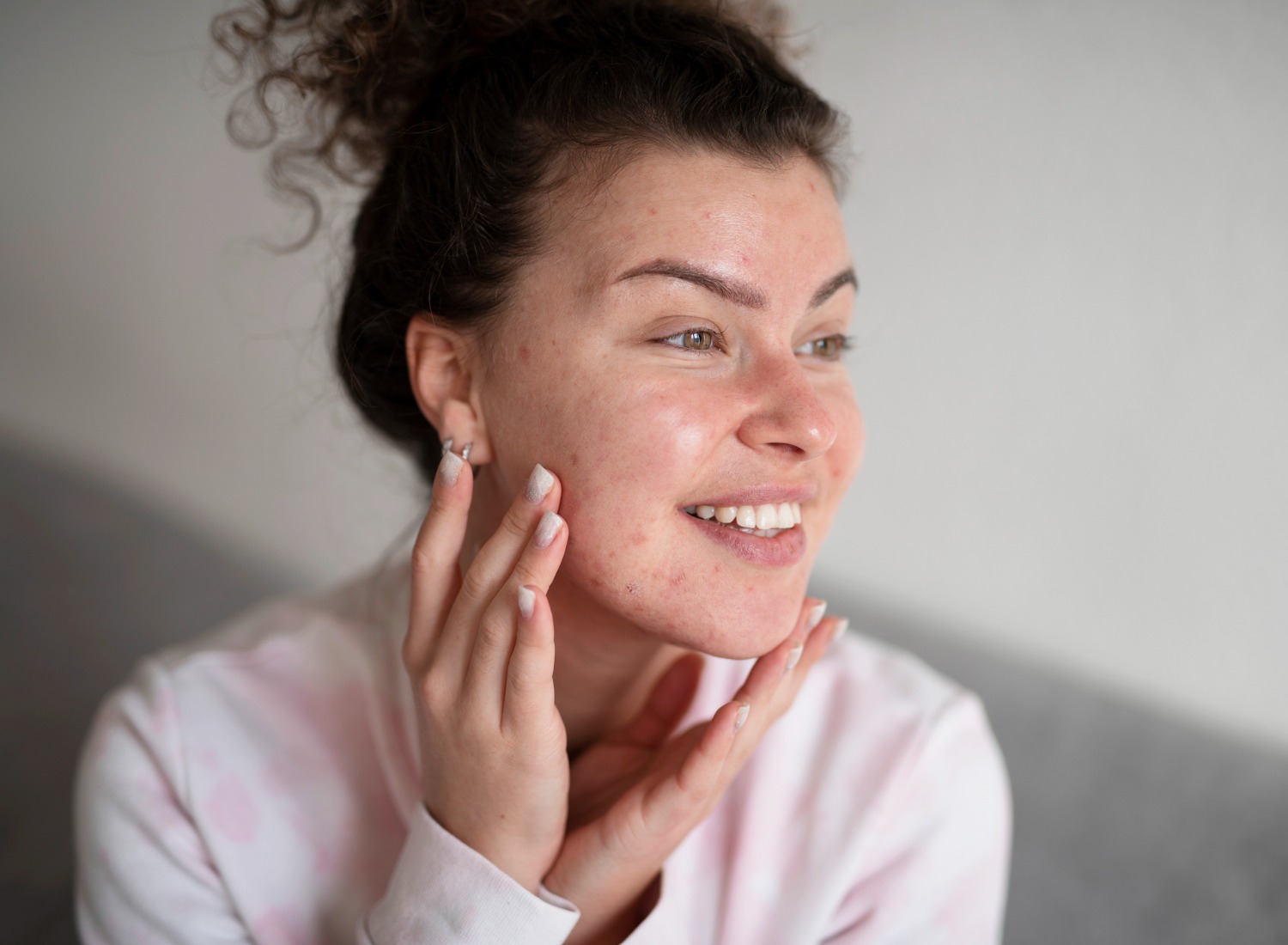 Acne vs. Pimples: The Difference and How to Treat Each | Buyers Report