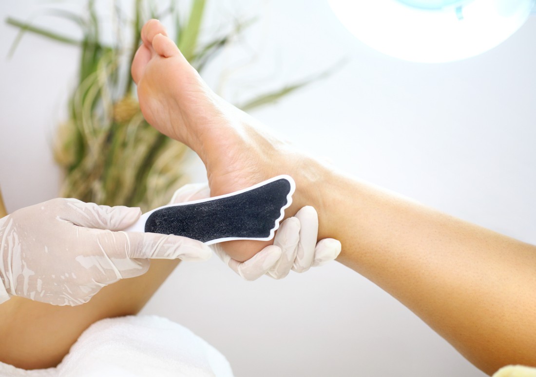 Keep Your Feet Feeling Soft and Smooth With the Best Foot Files ...